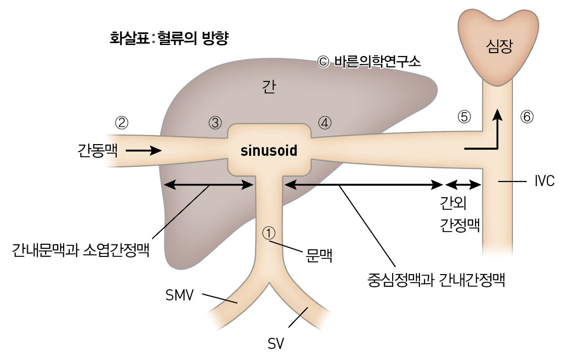 문맥압항진증 - Metamedic