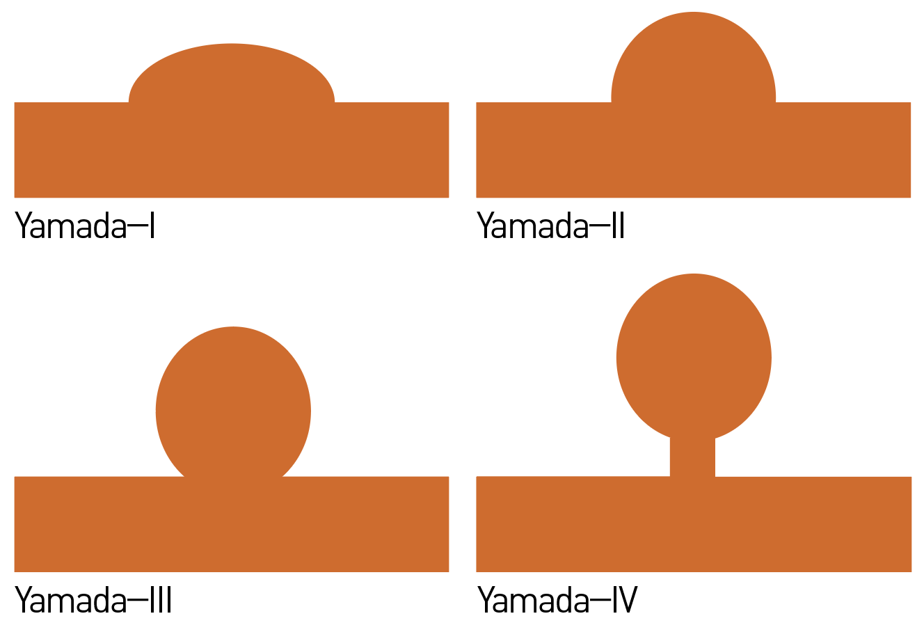 위용종(gastric polyp) - Metamedic