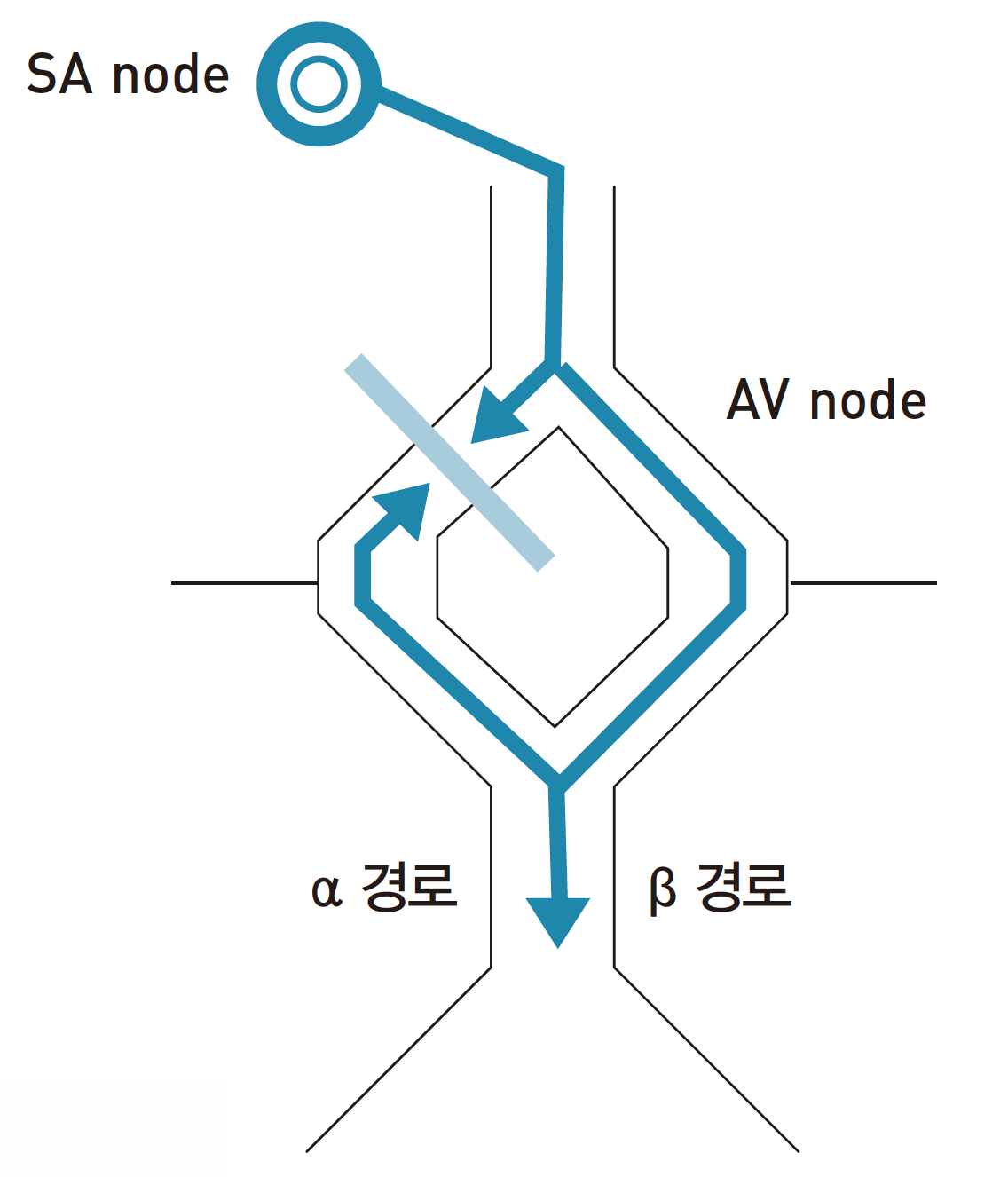 PSVT/WPW syndrome - 방실결절 회귀 빈맥 (AV nodal Reentrant Tachycardia, AVNRT ...