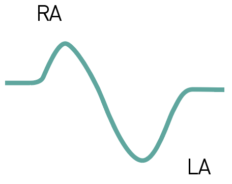심전도 판독의 기본 - Metamedic