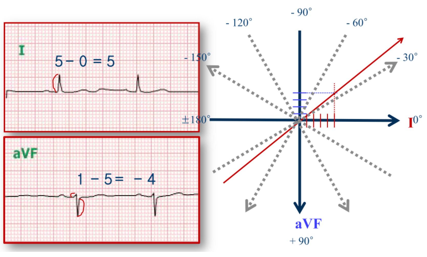 심전도 판독의 기본 - Metamedic