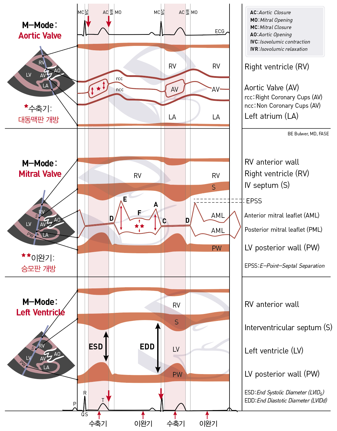 심초음파(Echocardiography) - Metamedic