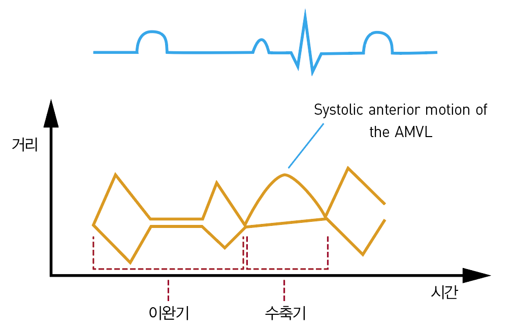 심초음파(Echocardiography) - Metamedic