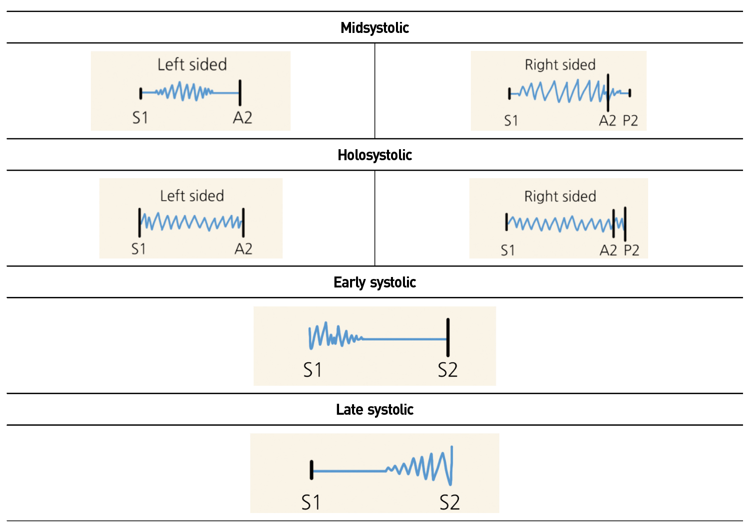 흉부(심혈관) 신체검사: 청진 - Metamedic