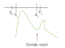 동맥진찰: 동맥압과 동맥파 - Metamedic