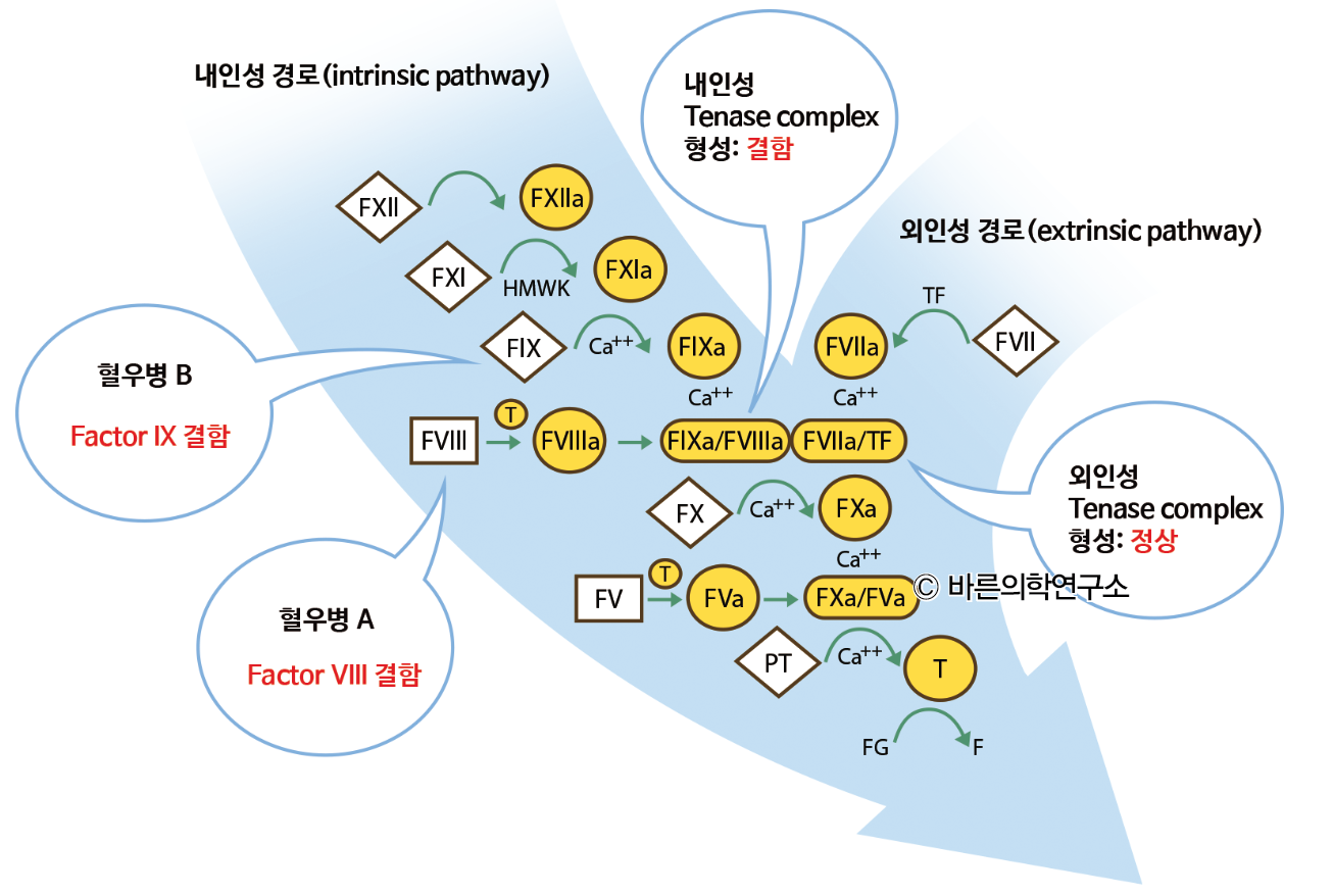 혈우병(Hemophilia) - Metamedic