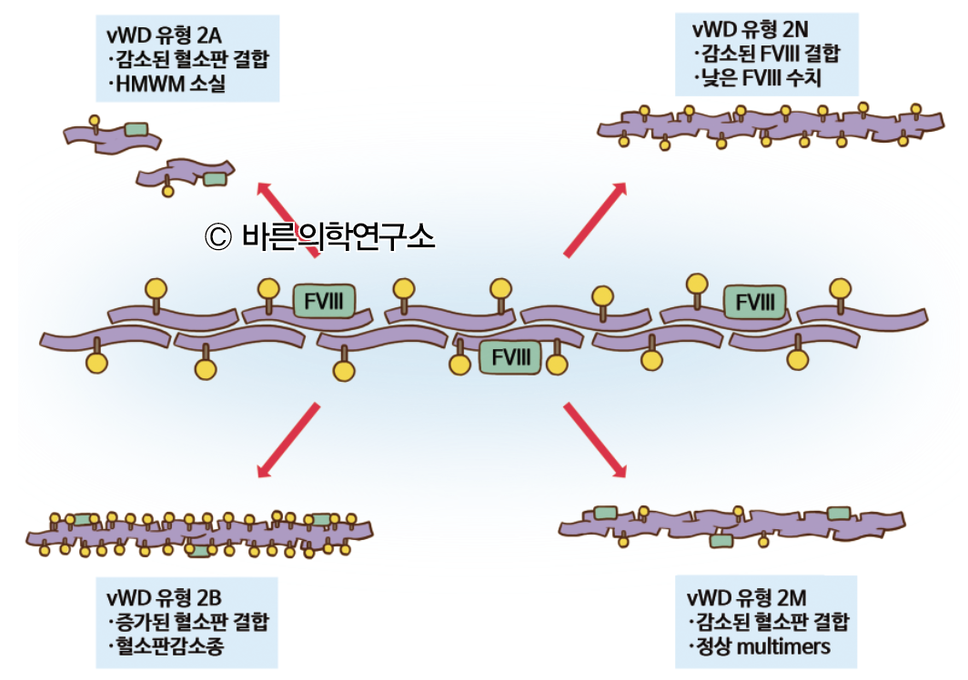 von-Willebrand’s disease (vWD) - Metamedic