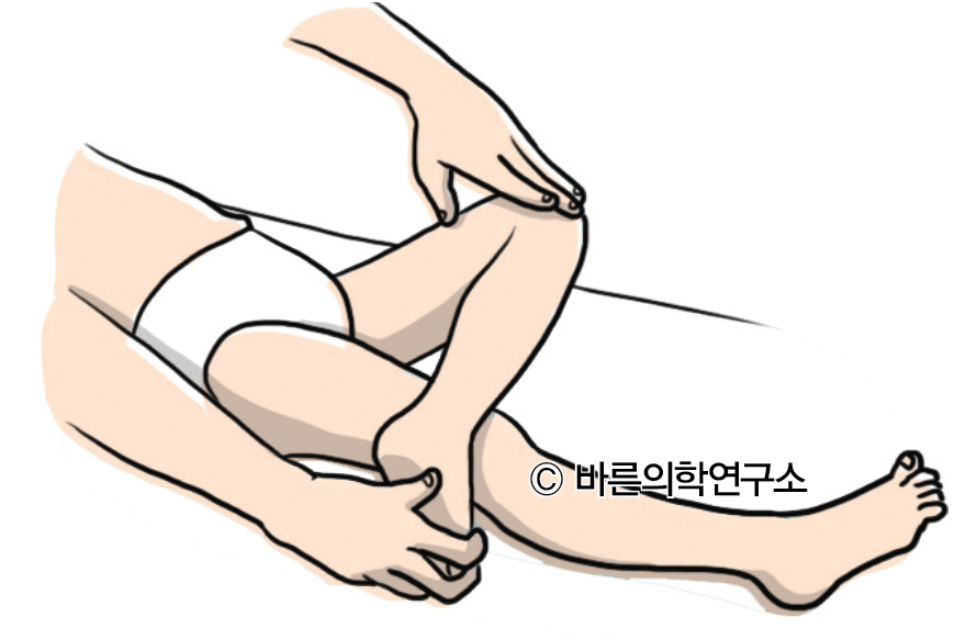 대퇴골두 골 괴사증(Osteonecrosis of the Femoral Head, ONFH) - Metamedic