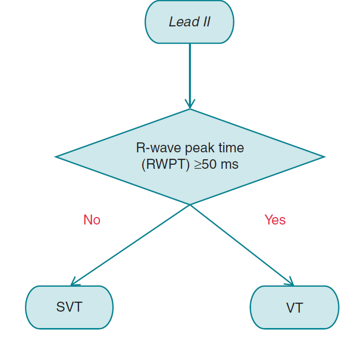 빈맥(Tachycardia)의 접근: 넓은 QRS 빈맥(Wide QRS Tachycardia) - Metamedic